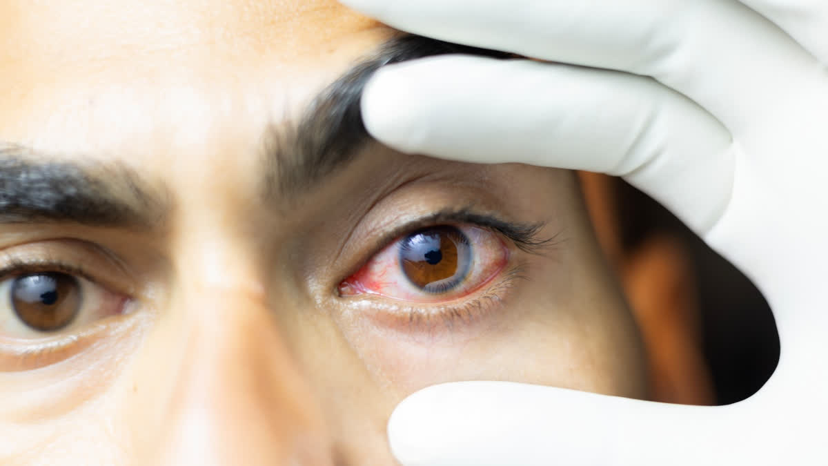 When Your Eyes Burn After Screen Time, Is It Just Eye Strain or Dry Eye ...