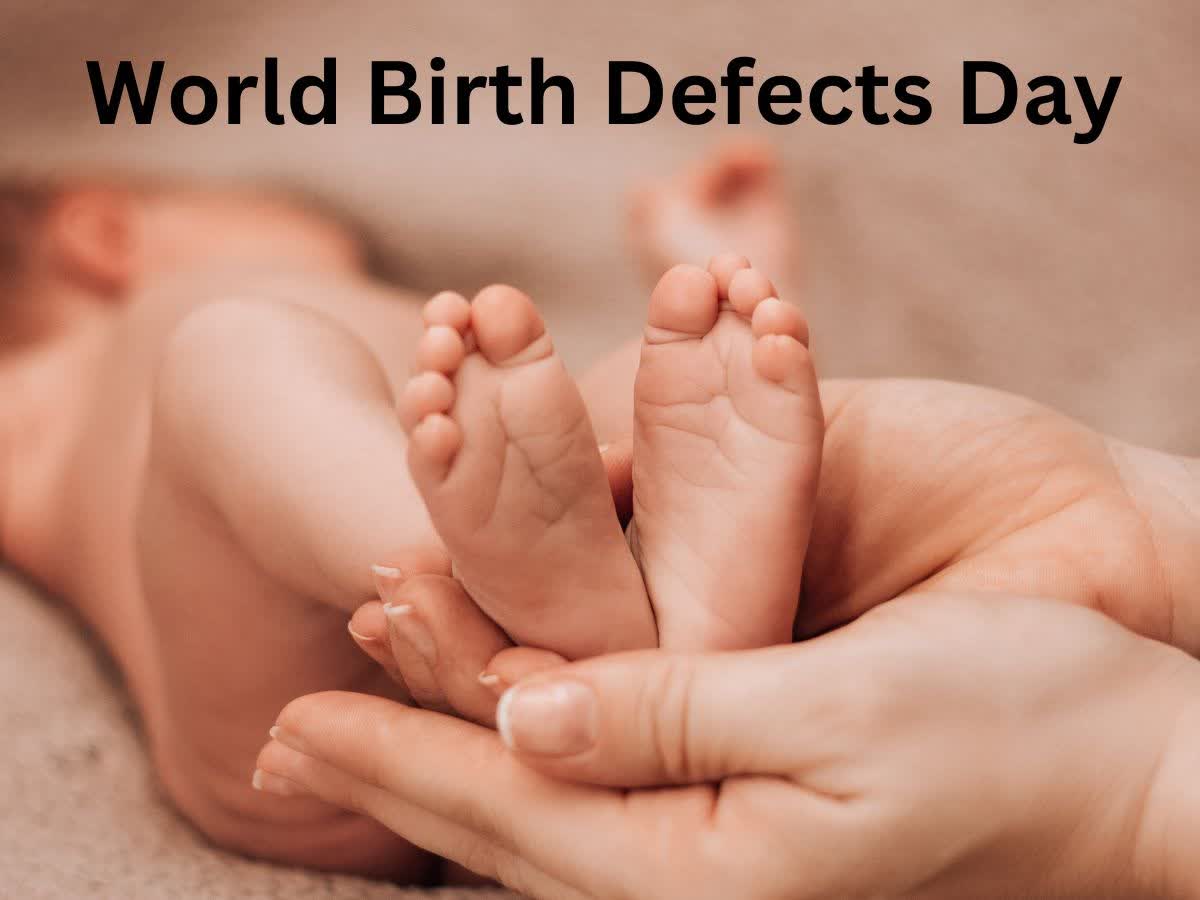 World Birth Defects Day 2023: ਜਨਮ ਤੋਂ ਹੀ ਬੱਚਿਆ ਨੂੰ ਹੋ ਸਕਦੀਆਂ ਨੇ ਇਹ ...