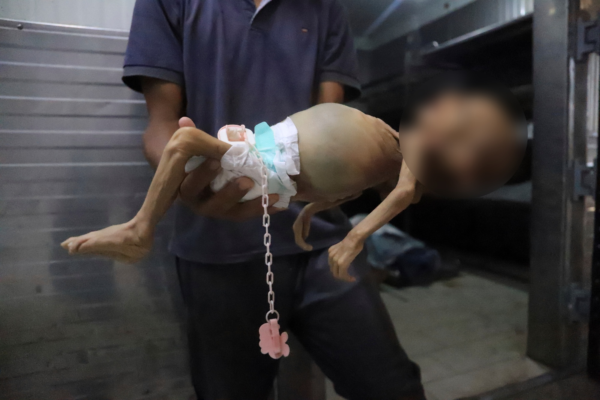 Zainab, 85th Child To Starve To Death In Gaza, Weighed Less Than When ...