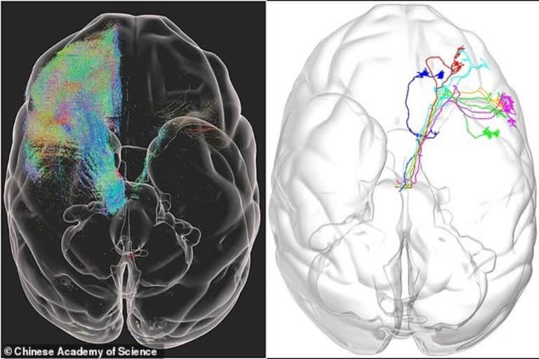 World's first 3D image of monkey brain developed